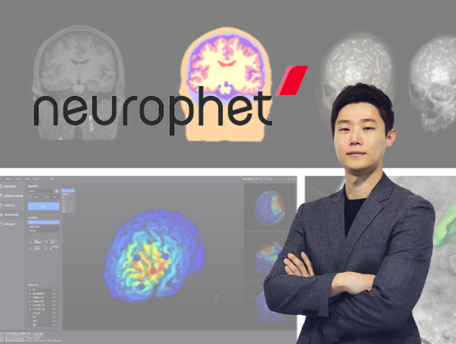 뇌 질환 극복의 길 비추는 뇌비게이션 스타트업 뉴로핏 이야기 쉽고 재미있는 It뉴스 아웃스탠딩
